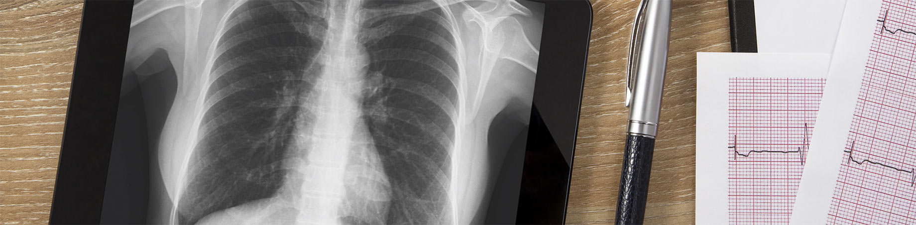 Tuberculosis Clinic | Public Health Institute at Denver Health